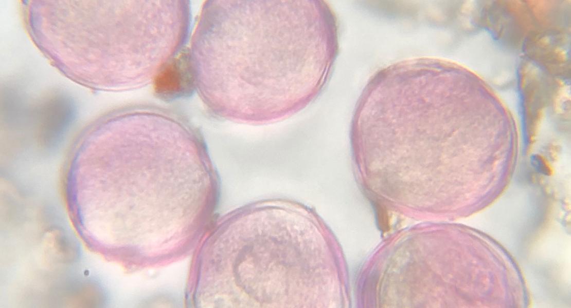 Elm Pollen Starting to Release | Allergy and Asthma Center of Western ...